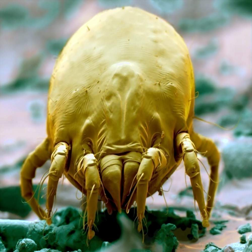 Dermatophagoides Pteronyssinus; European House Dust Mite; House Dust ...